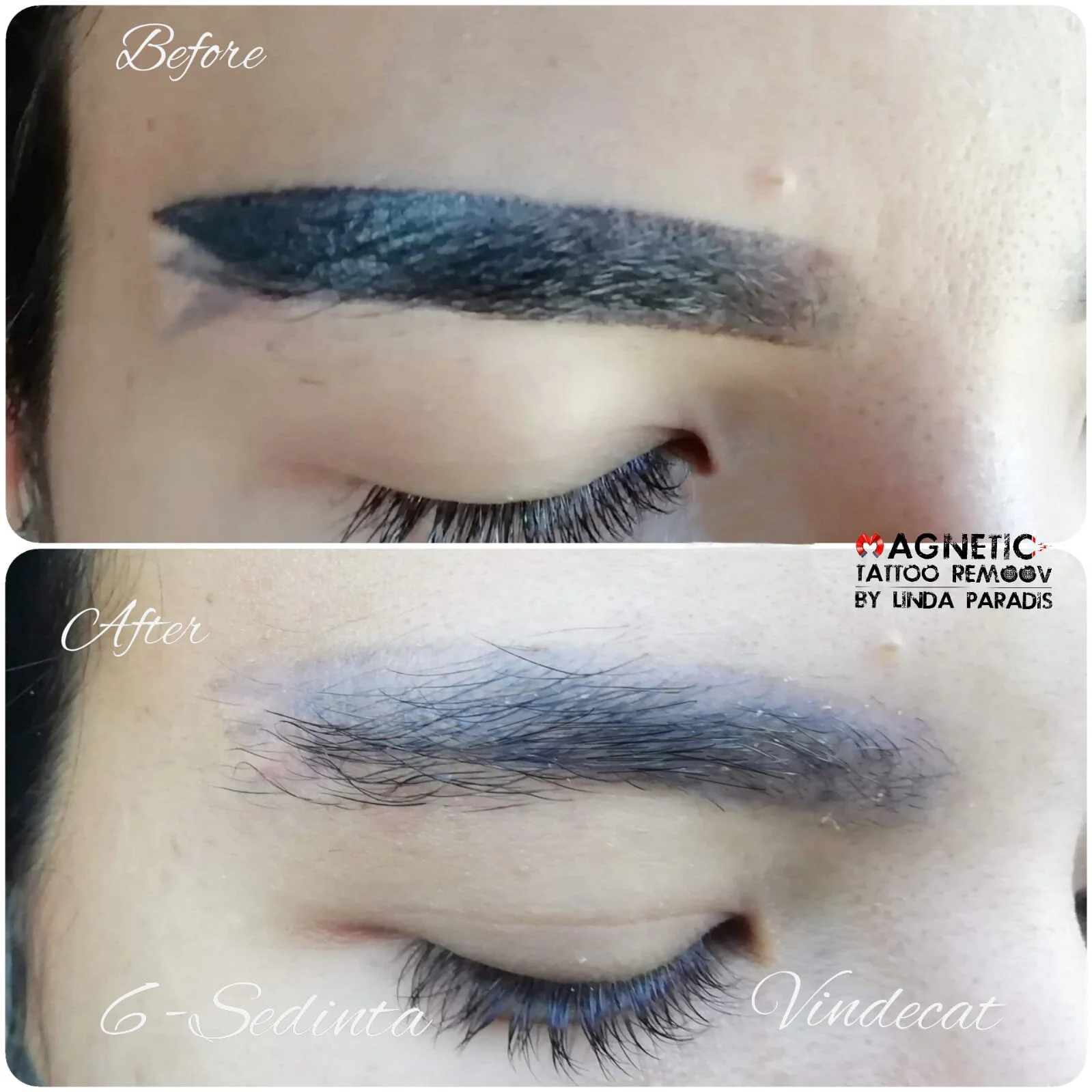 Alkaline Before And After Eye Tattoo