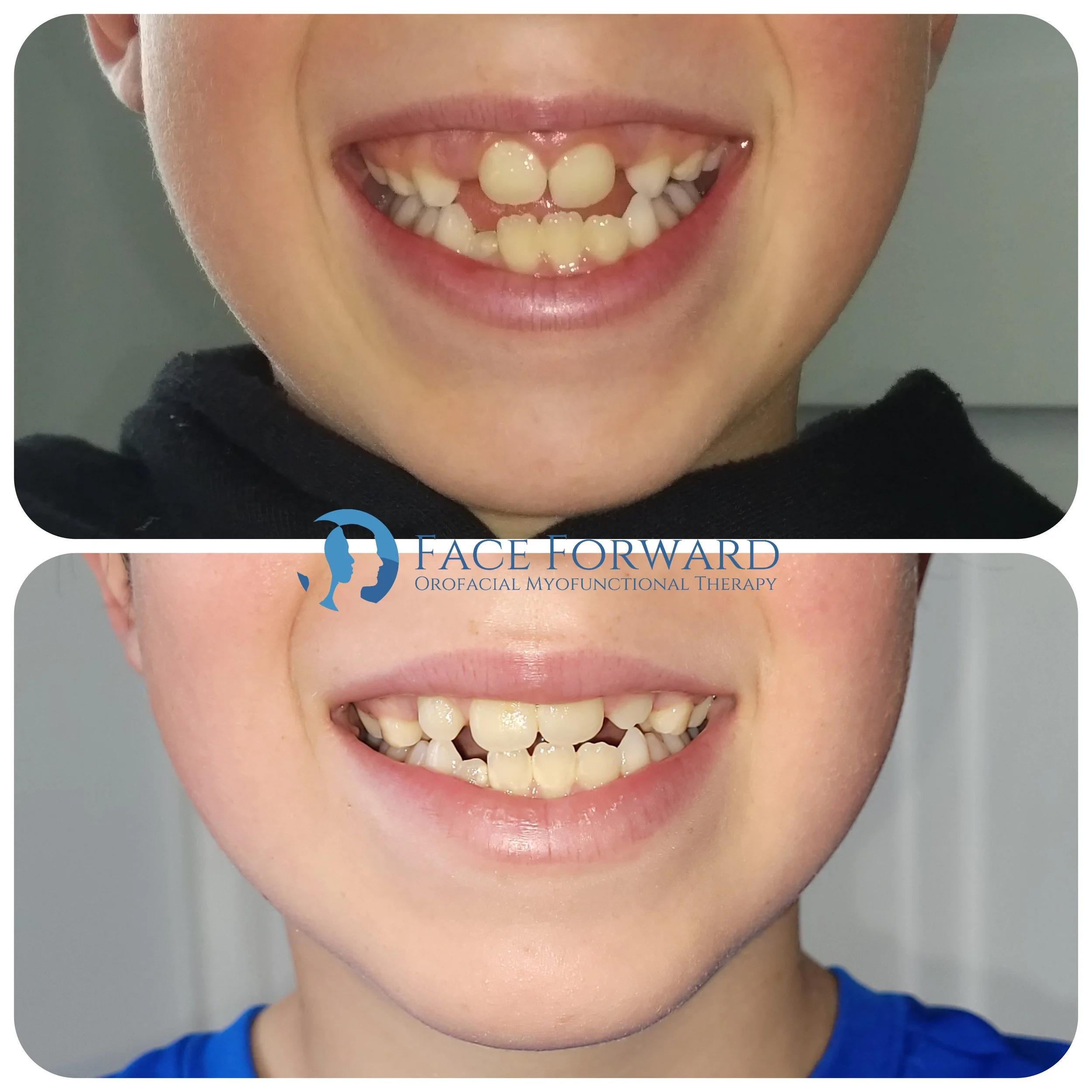 Results — Face Forward