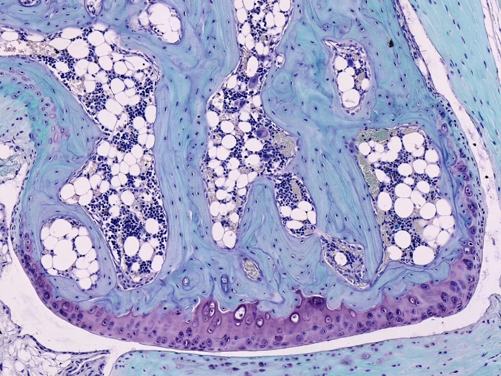 News - Arthritis Treatment Research of Cartilage Regeneration — HIMED ...