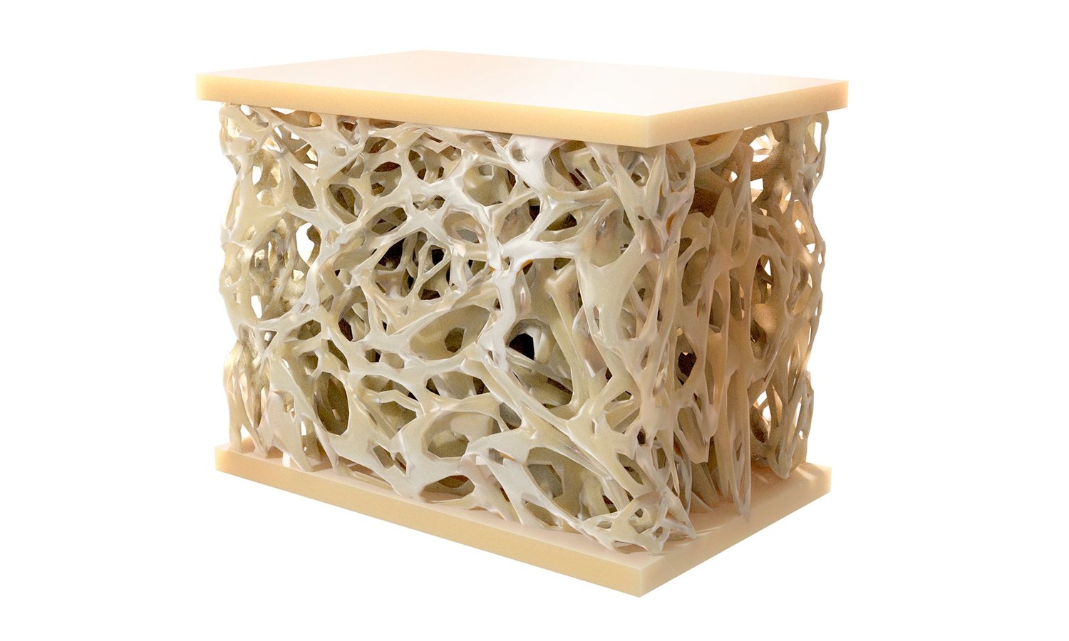 Synthetic Bone Grafts: Definitions, Types, and Materials — HIMED