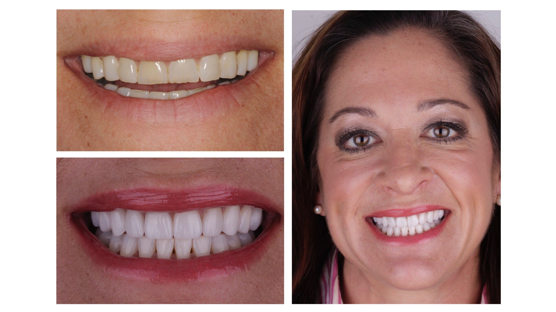 Palmetto Dental Associates — Full Mouth Makeovers