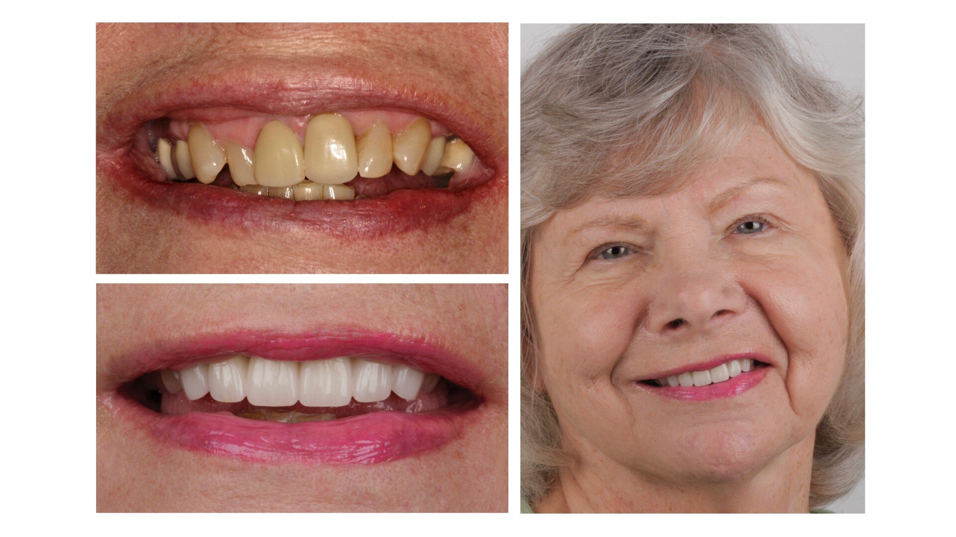 Palmetto Dental Associates — Full Mouth Makeovers