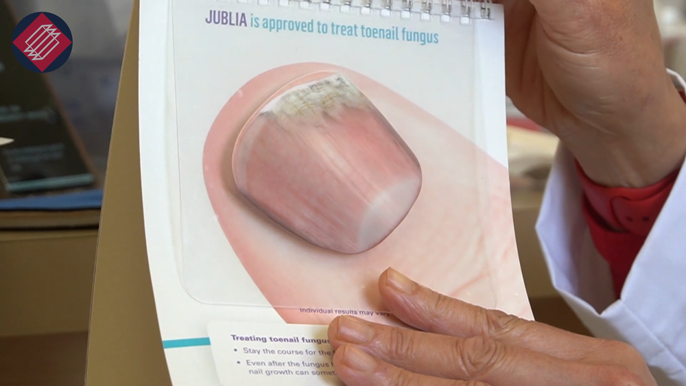 Foot Doctor Explains Treatments for Toenail Fungus — AAMG Doctors