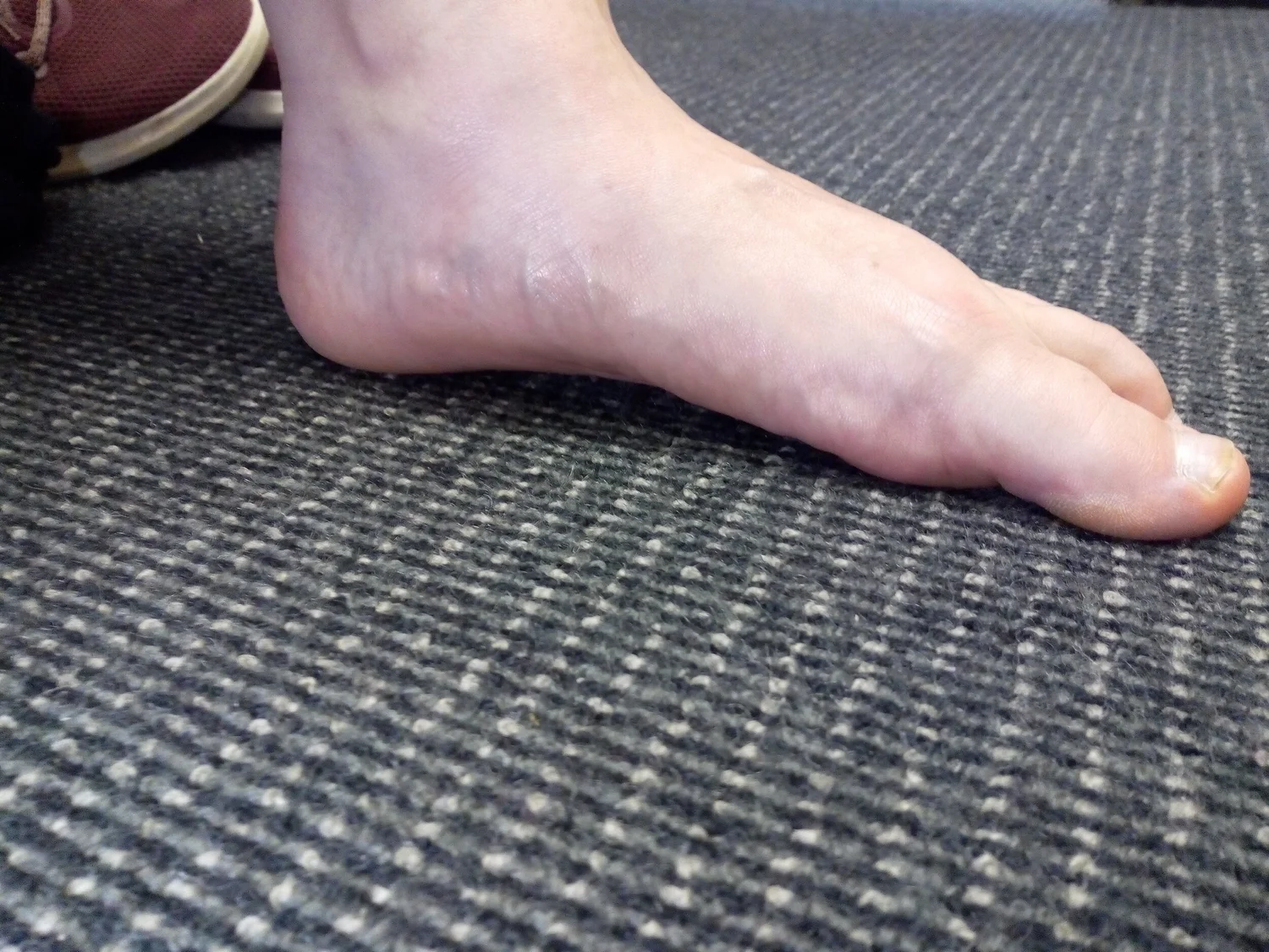 Flat Feet Case Study With Kirill Volkov — ONI | Wellington Personal ...