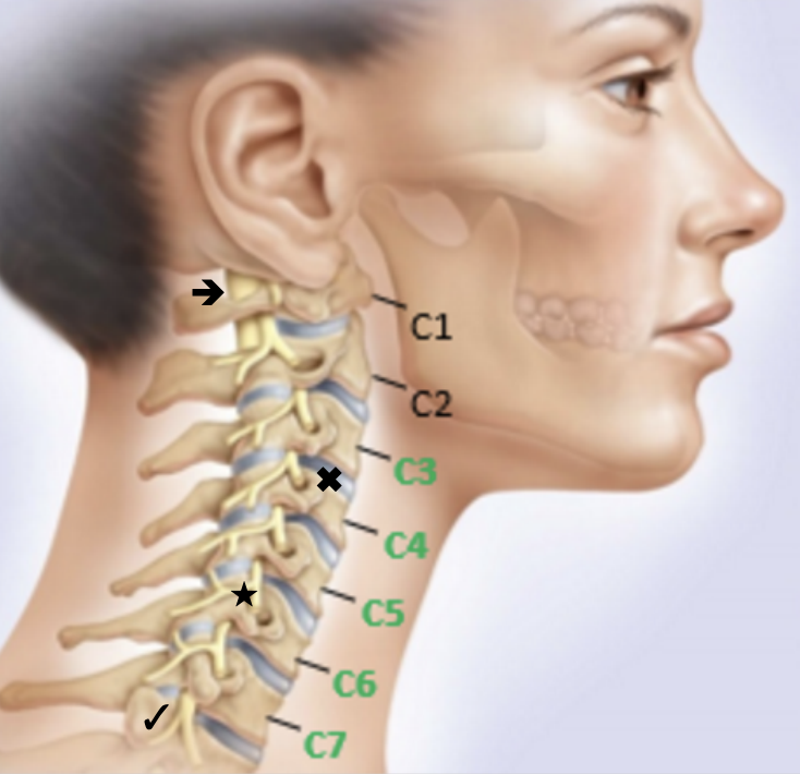 Neck Anatomy — Neuro Rehab Coach