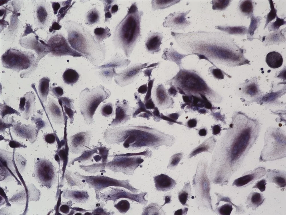 BLUESTONE LAB, UCSF — Jacqueline Howells