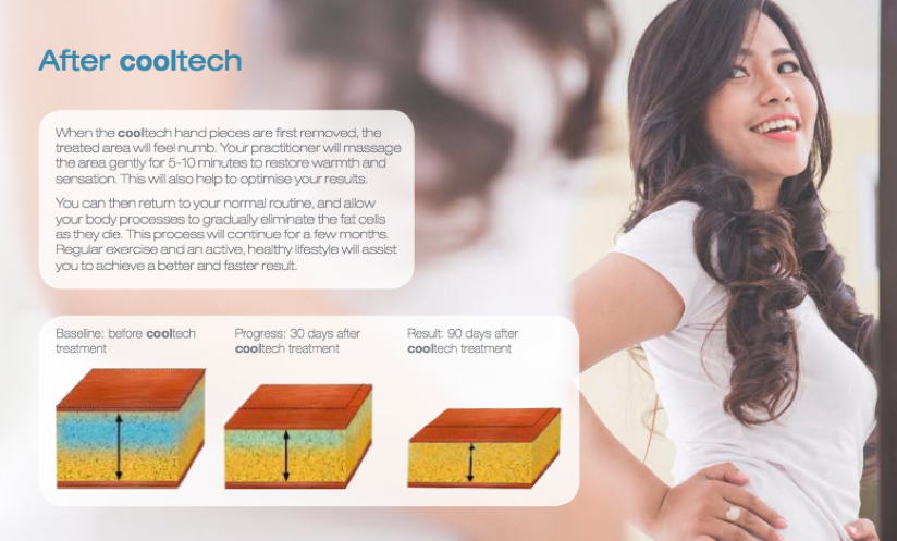 Fat Freezing Perth | Cool Tech Fat Freeze Perth — Body Wisdom Perth
