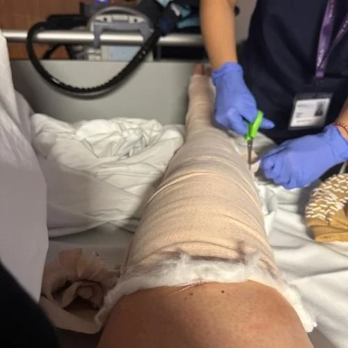 Physio Sarah’s Own Patient Story – Navigating Knee Surgery and Recovery ...