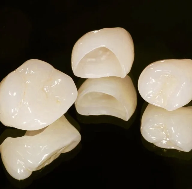 Crowns, Veneers, Inlays & Onlays — Fusion Oral Art