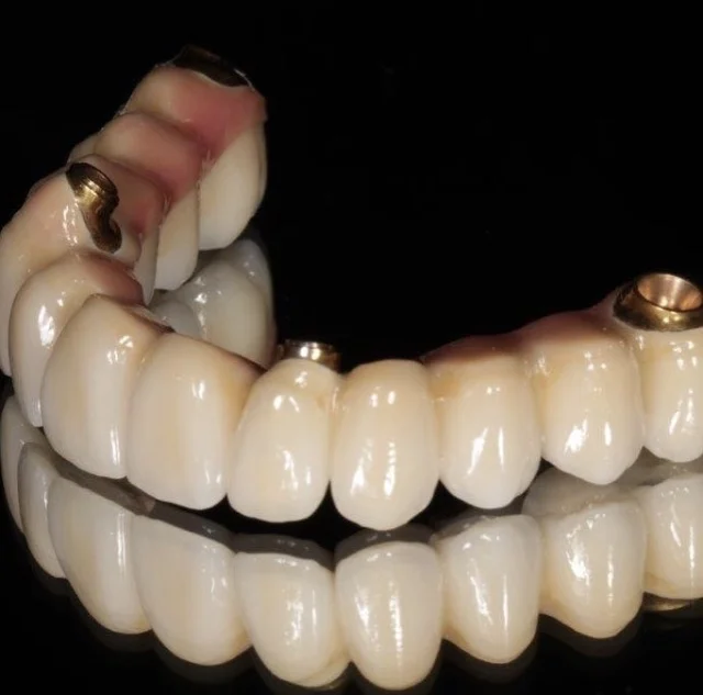 Procera Implant Crowns