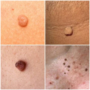 What Does The Skin Classic Treat? — Sharon Gordon SKIN