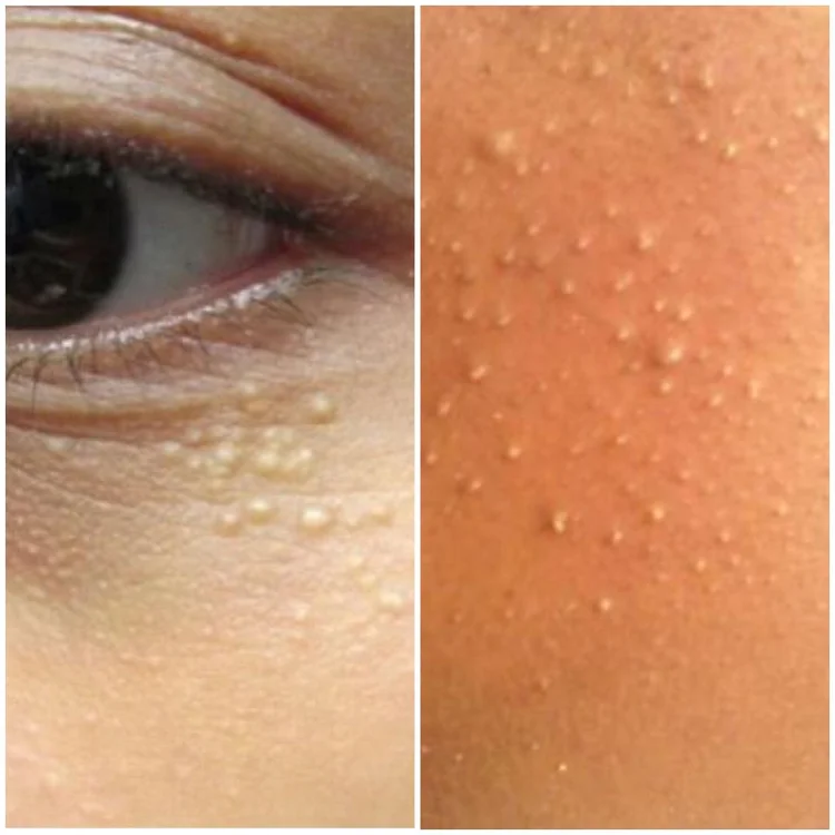 What Does The Skin Classic Treat? — Sharon Gordon SKIN