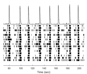 Cortical GABAergic Neurons — BrainXell