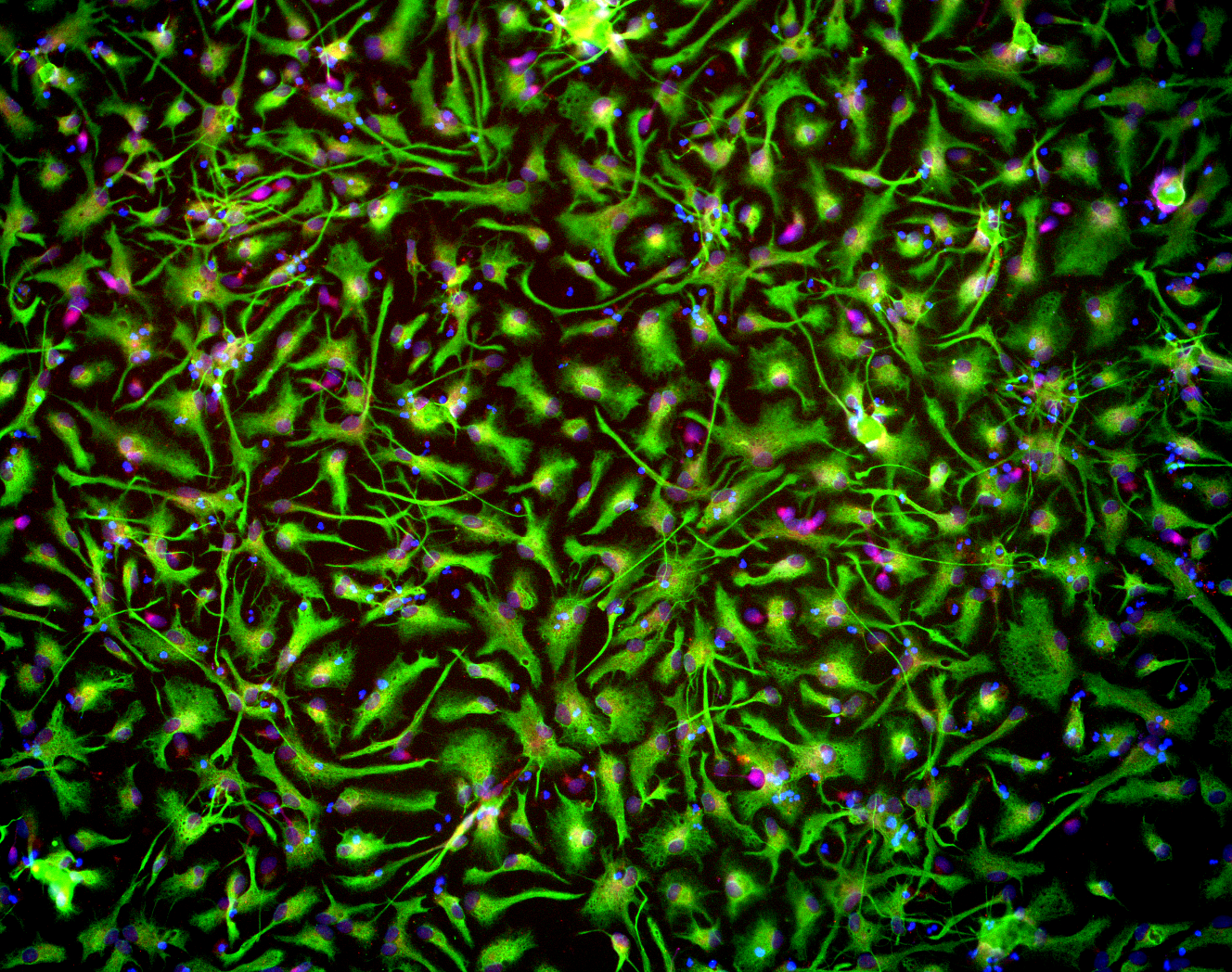 Cortical Astrocytes BrainXell Cortical Astrocytes BrainXell