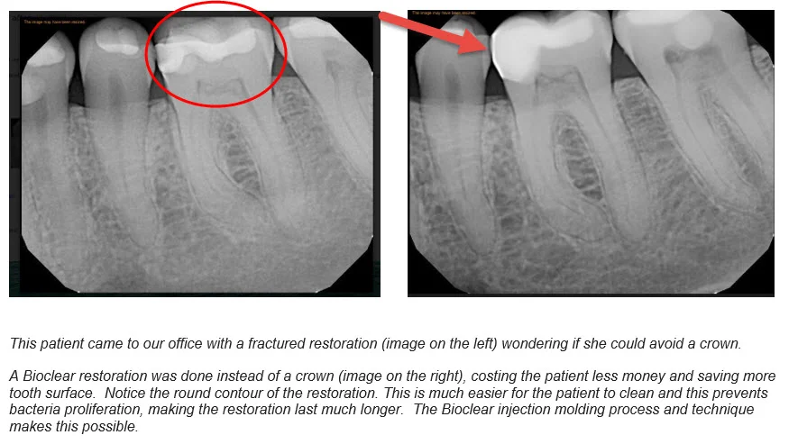 BioClear — Dr. Carmen Burke