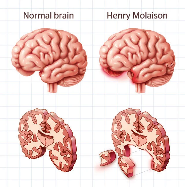 The Brain: the Story of You — artibiotics