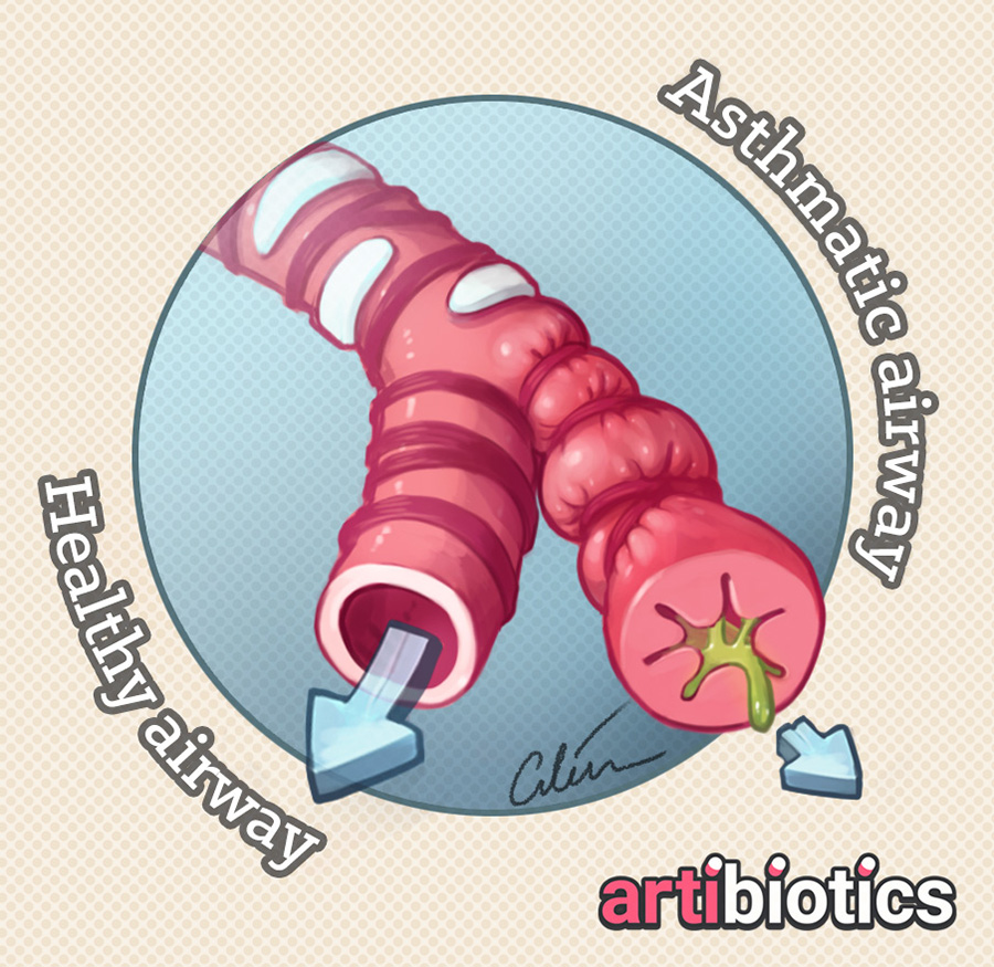 Causes of chest pain — artibiotics