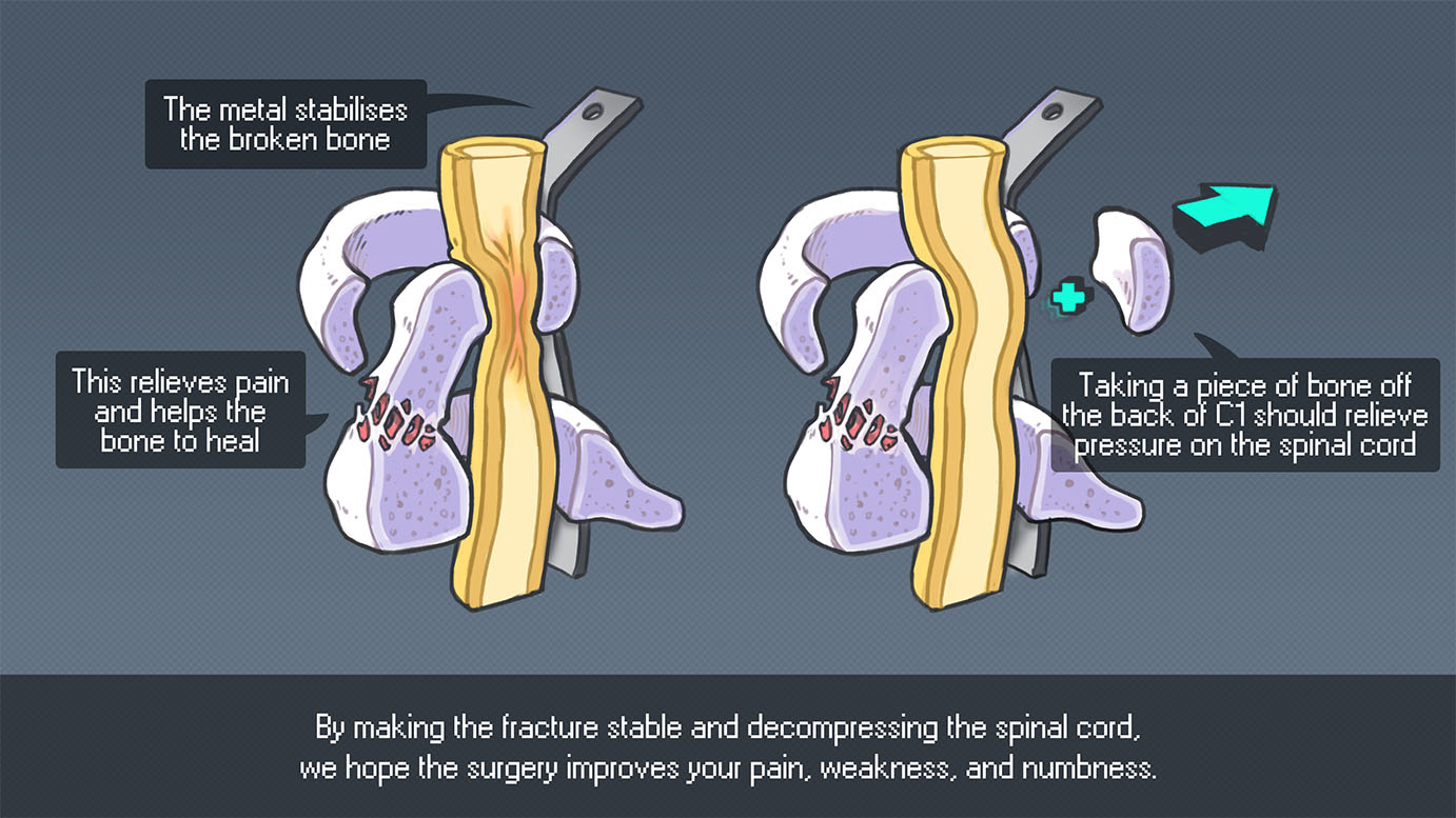 Fixing a broken neck: an illustrated case journey — artibiotics