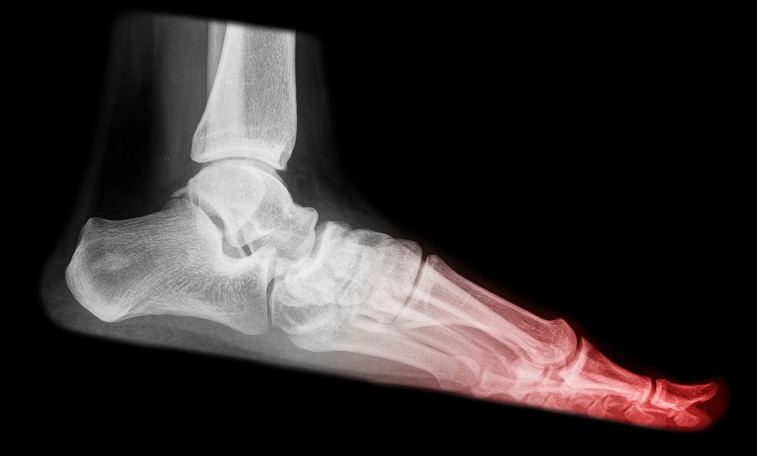 Foot, Ankle & Heel Pain Specialists. | Podiatrists & Pain Specialists ...