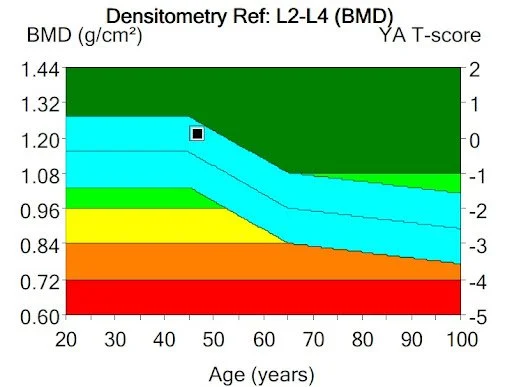 Bone Density Tests: DEXA vs. REMS Explained - The Three Tomatoes