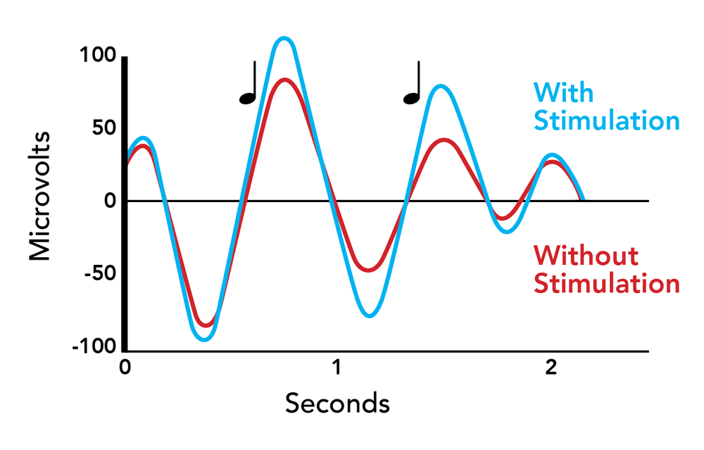 NeuroGevity — NeuroGeneces