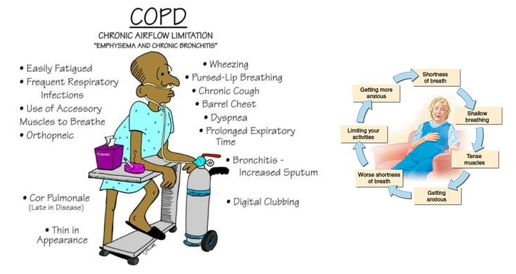 Chronic Obstructive Pulmonary Disease (COPD) Symptoms — Allied Health ...