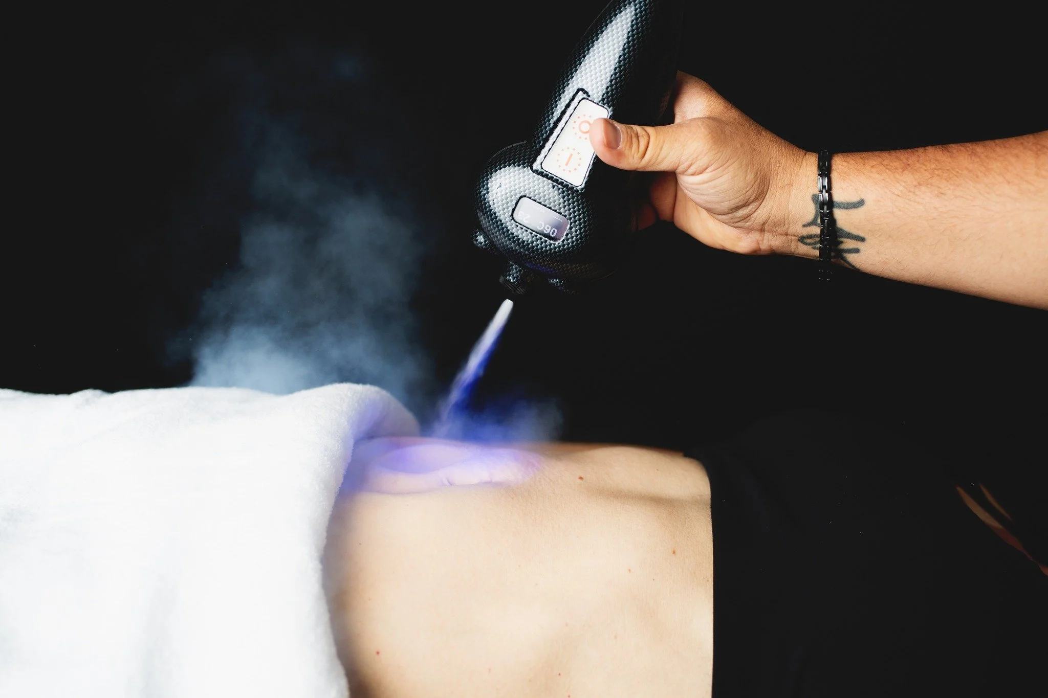 Cryo in Raleigh, NC — Skin Sense