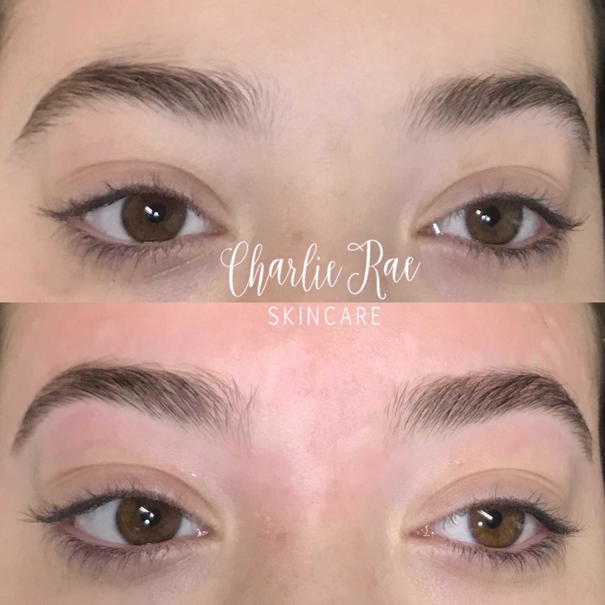 Charlie Rae Skincare