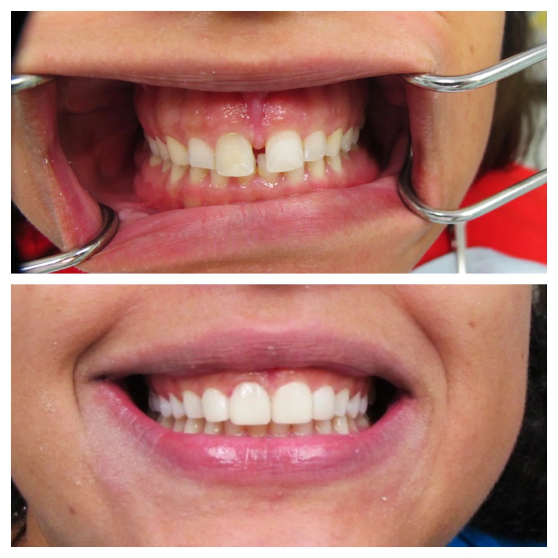 Smile Gallery | Dentists and Dentistry | Saddle Brook | Woodcliff Lake | New Jersey — Ameri ...