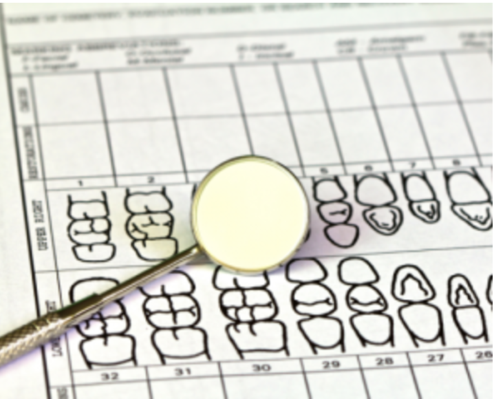 Periodontal Charting