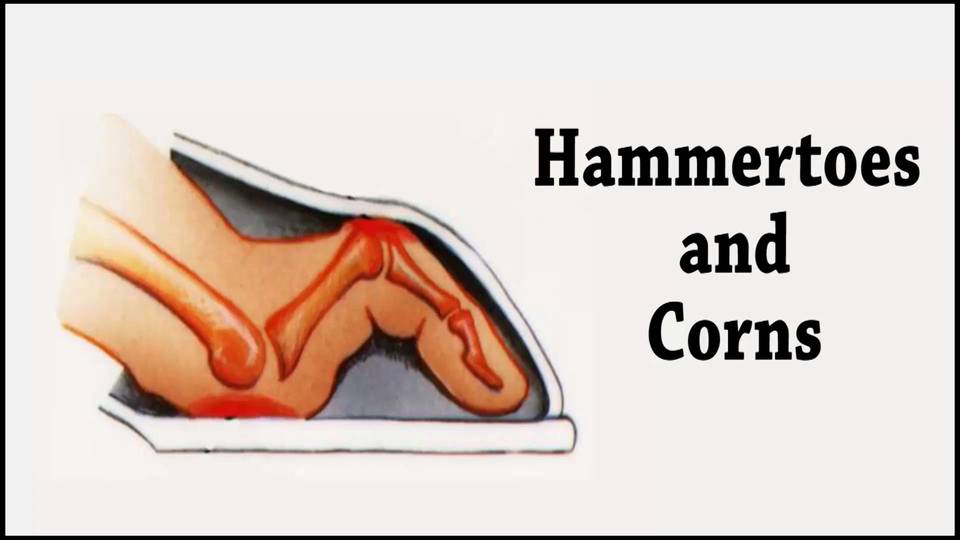 Foot & Ankle Medical Center at Jane Hankerson blog