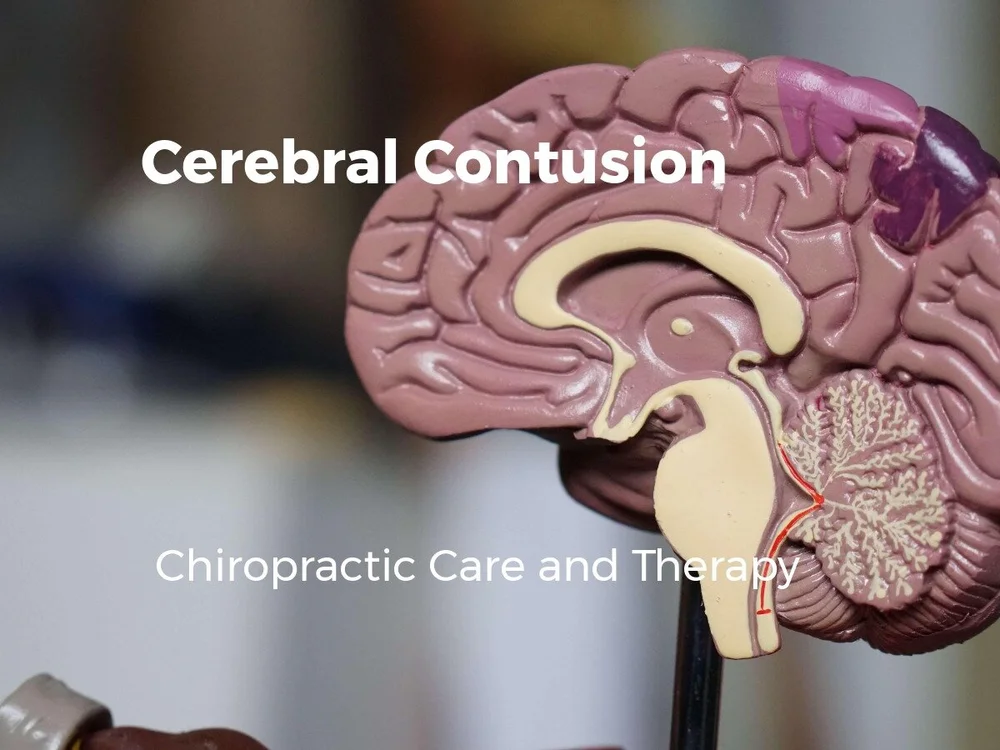 Cerebral Contusion — Physical Rehabilitation in Nevada City