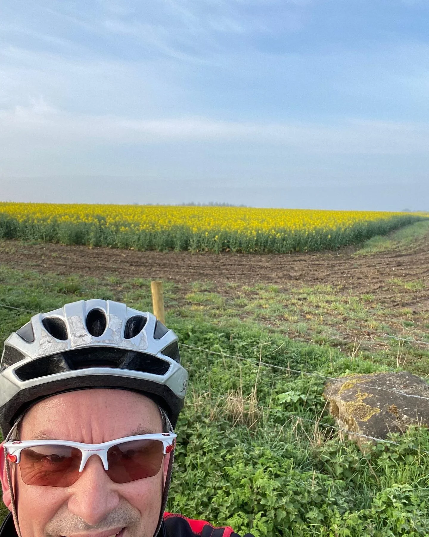 Bunion Hallux Valgus — South West Foot Surgery