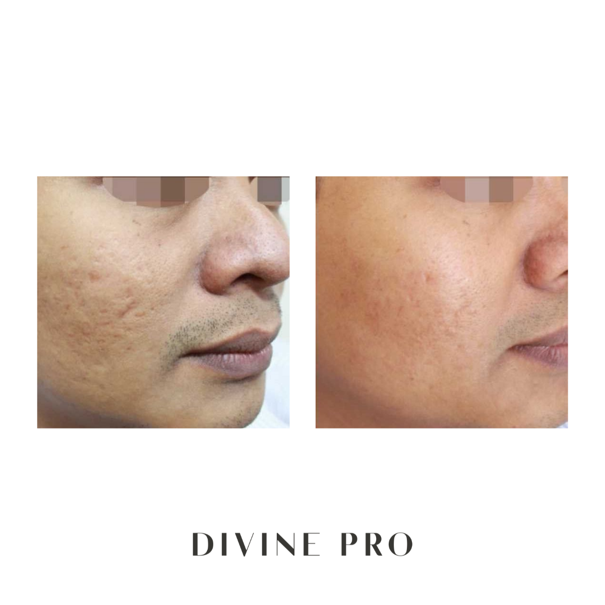 Divine Pro — Sphere Medi Spa
