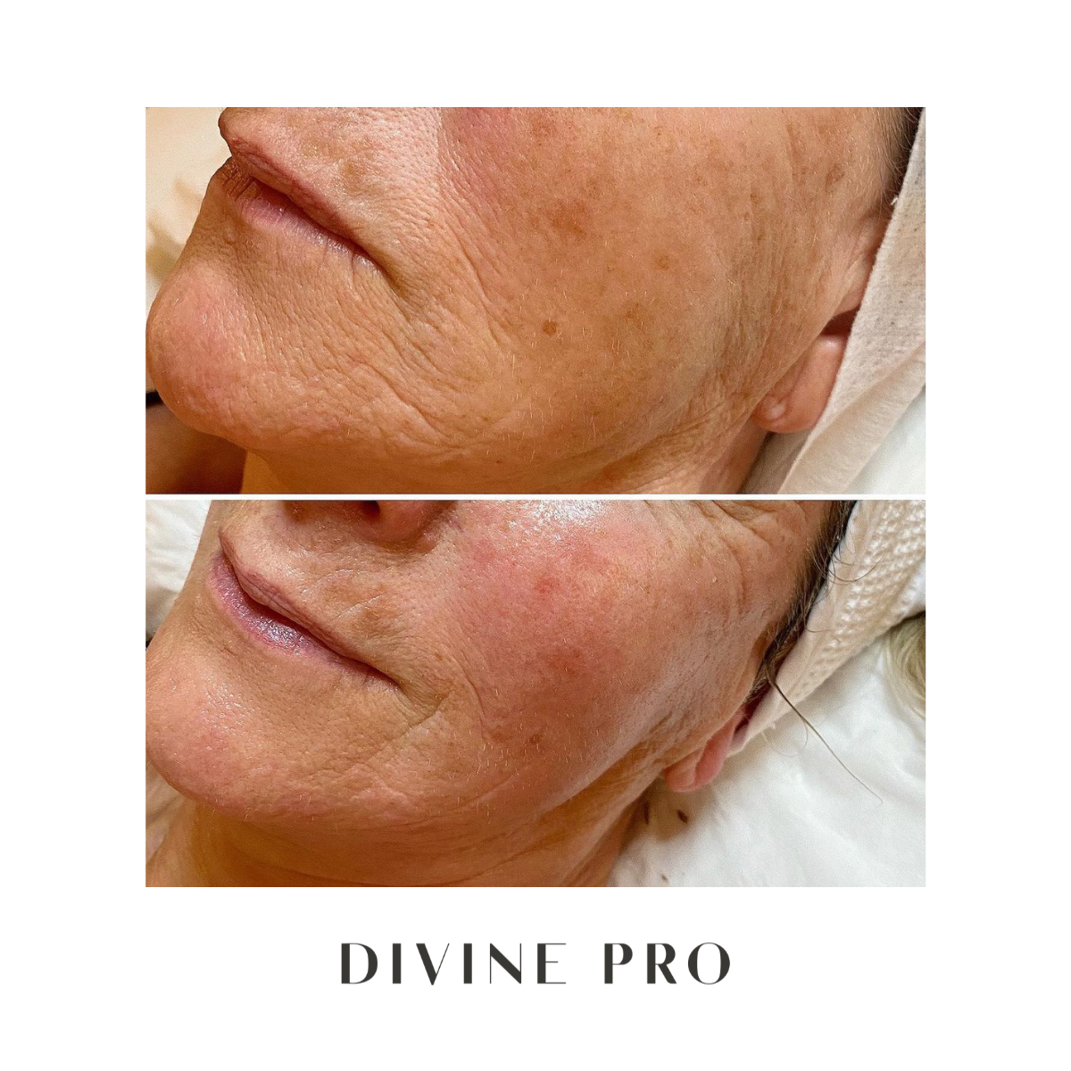 Divine Pro — Sphere Medi Spa