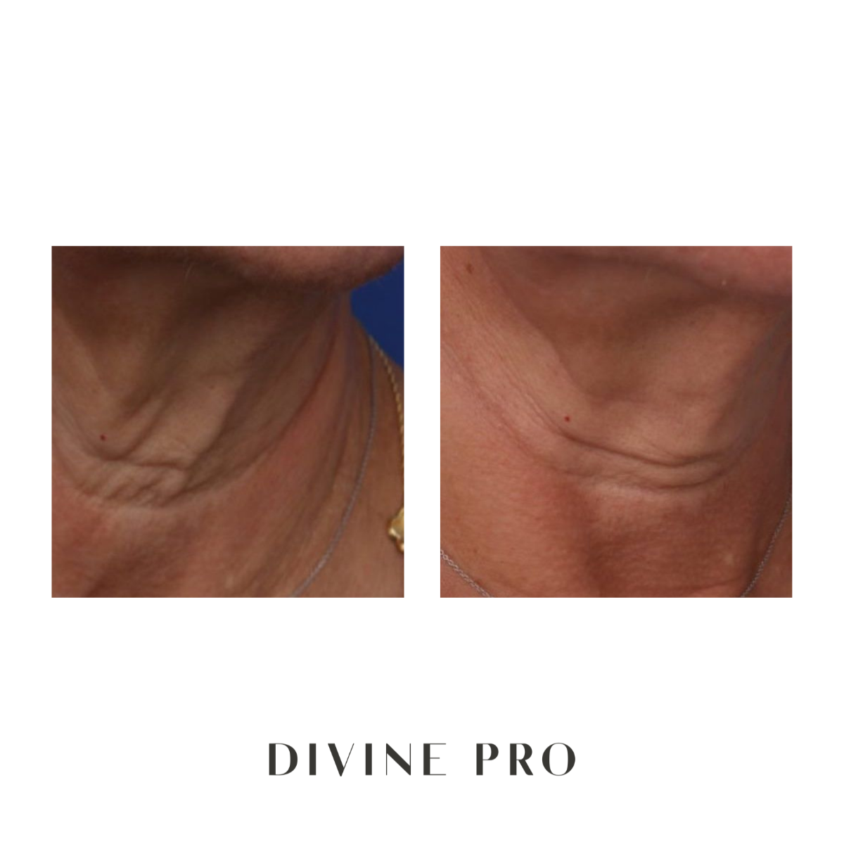 Divine Pro — Sphere Medi Spa