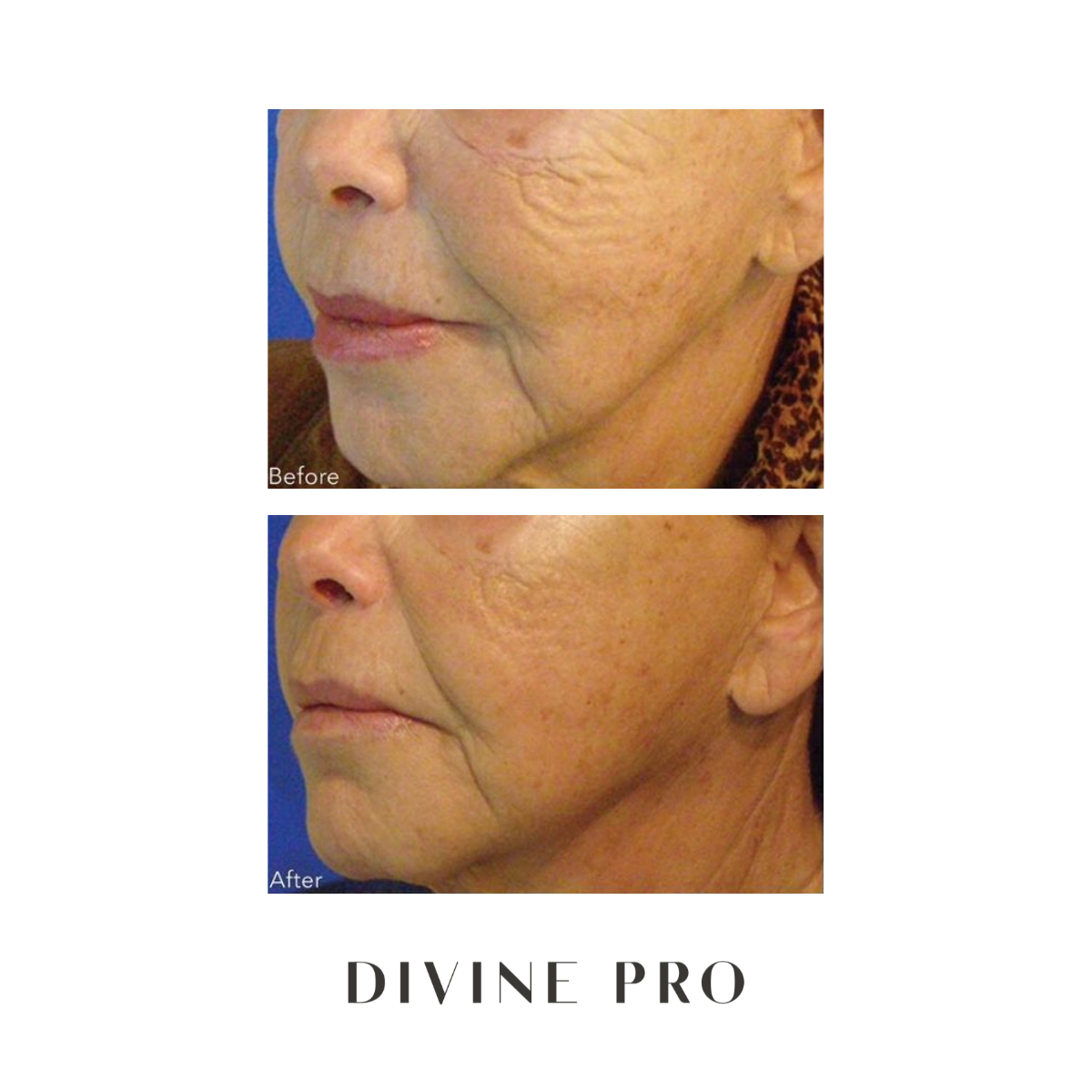 Divine Pro — Sphere Medi Spa