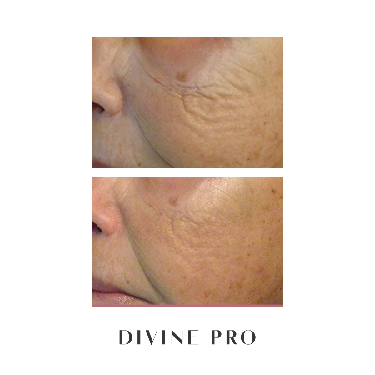 Divine Pro — Sphere Medi Spa