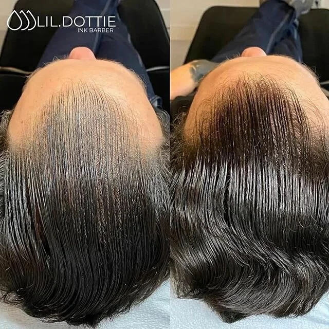 INKBARBER Home INKBARBER - VANCOUVER'S SCALP MICROPIGMENTATION LEADERS