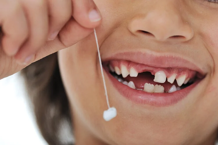Why Are My Child’s Baby Teeth Not Falling Out? | Jorgensen Orthodontics ...