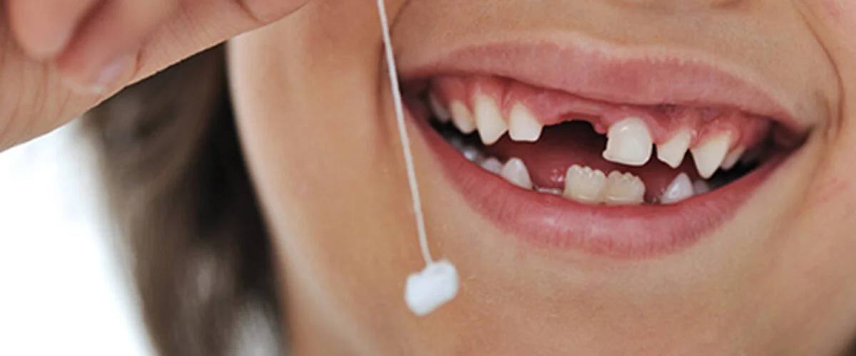 At What Age Do Baby Teeth Normally Fall Out? | Jorgensen Orthodontics ...