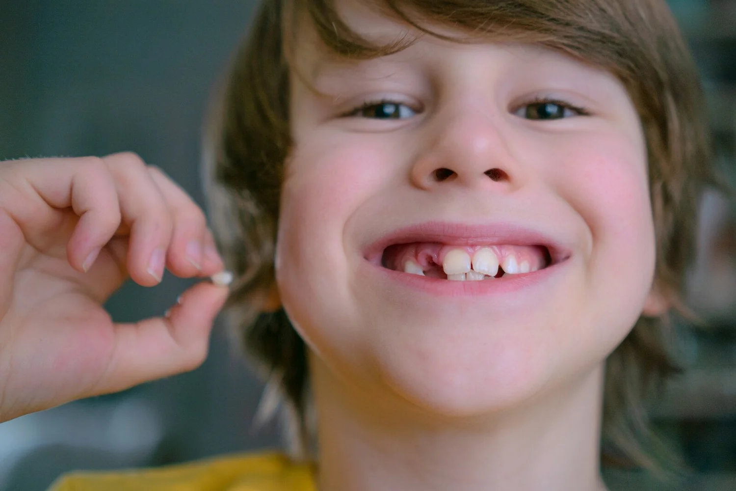 Baby Teeth and Braces | Jorgensen Orthodontics - Affordable Care