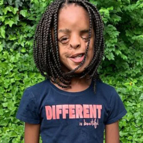 Destiny, 11, with rare condition, inspires! — EEW Magazine