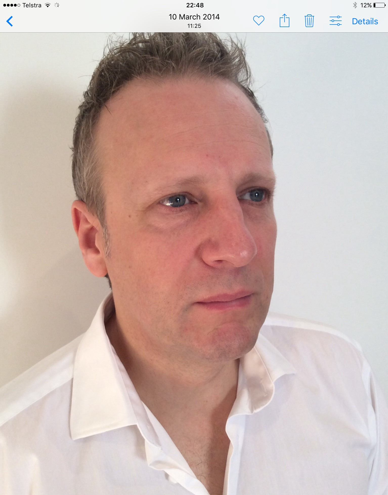 CACI Microcurrent Facials & Treatments for Surrey Hills / Mont Albert ...