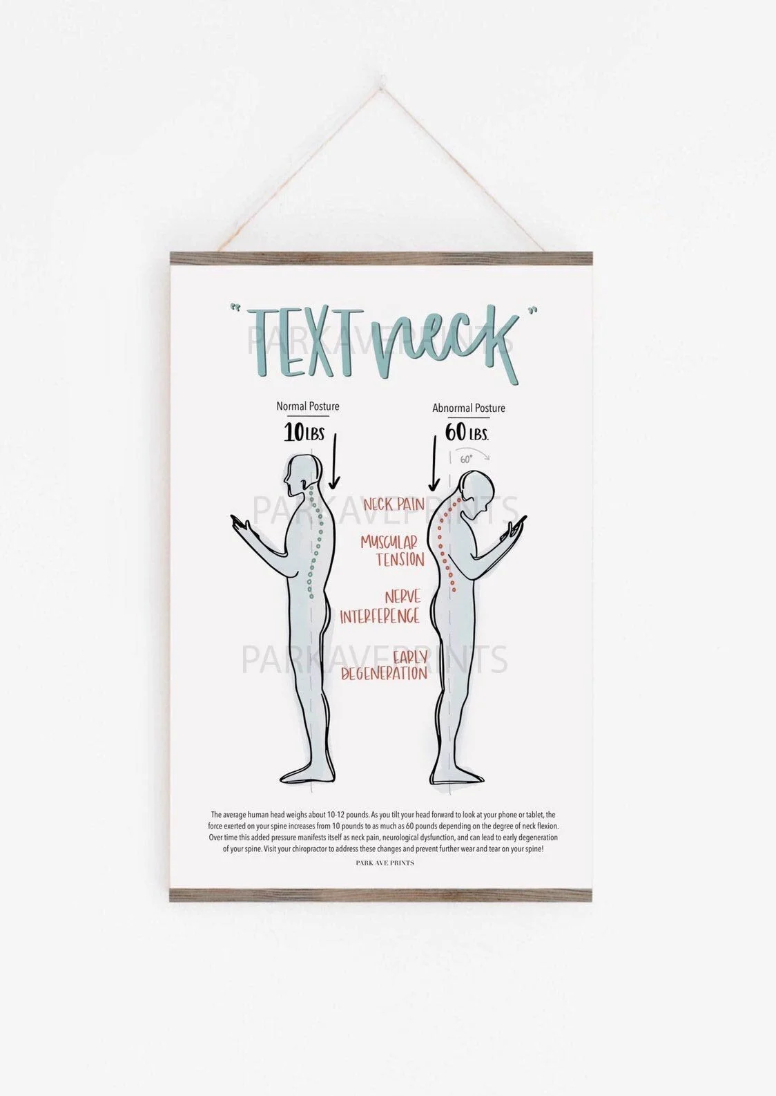 Vertebral Subluxation Complex — Park Ave Prints