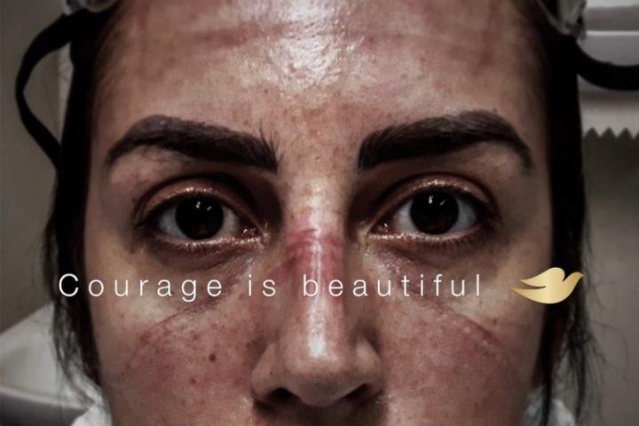 Dove’s Marketing Strategy, 5 Keys to its Success