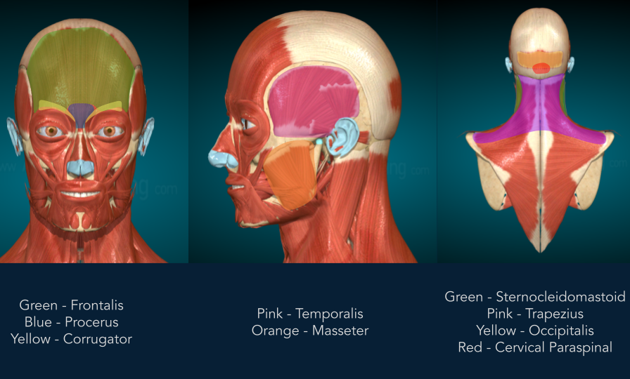 Injectables for TMD, Bruxism & Migraine — Krina Panchal - Specialist ...