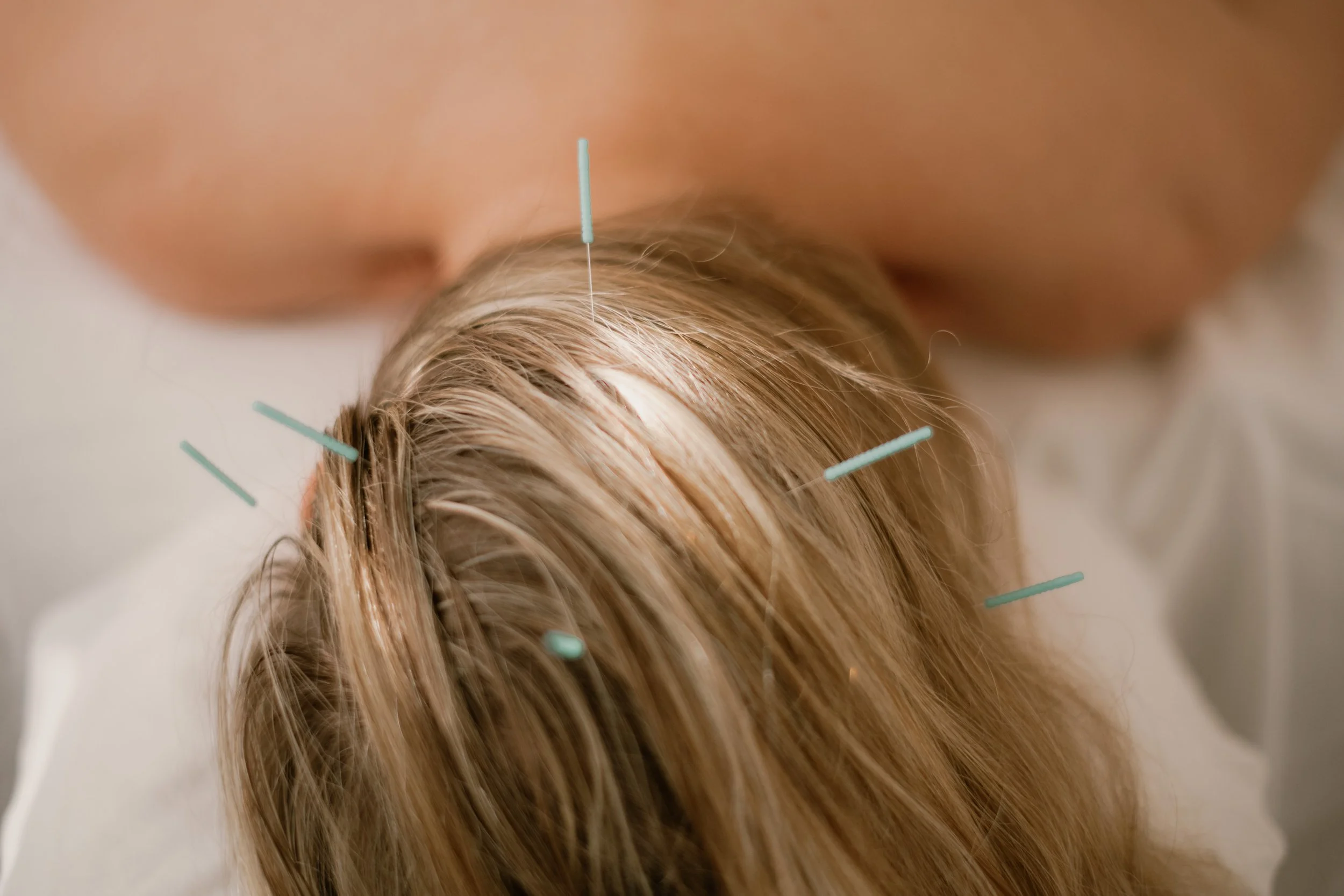 What is Esoteric Acupuncture? | Esoteric Acupuncture Orange County ...