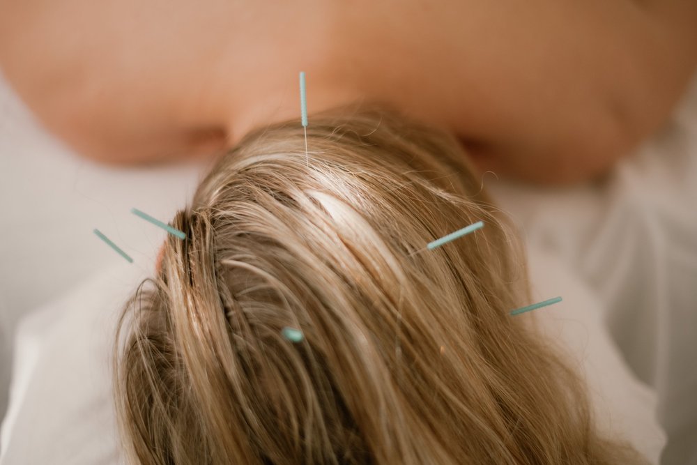 What is Esoteric Acupuncture? | Esoteric Acupuncture Orange County ...