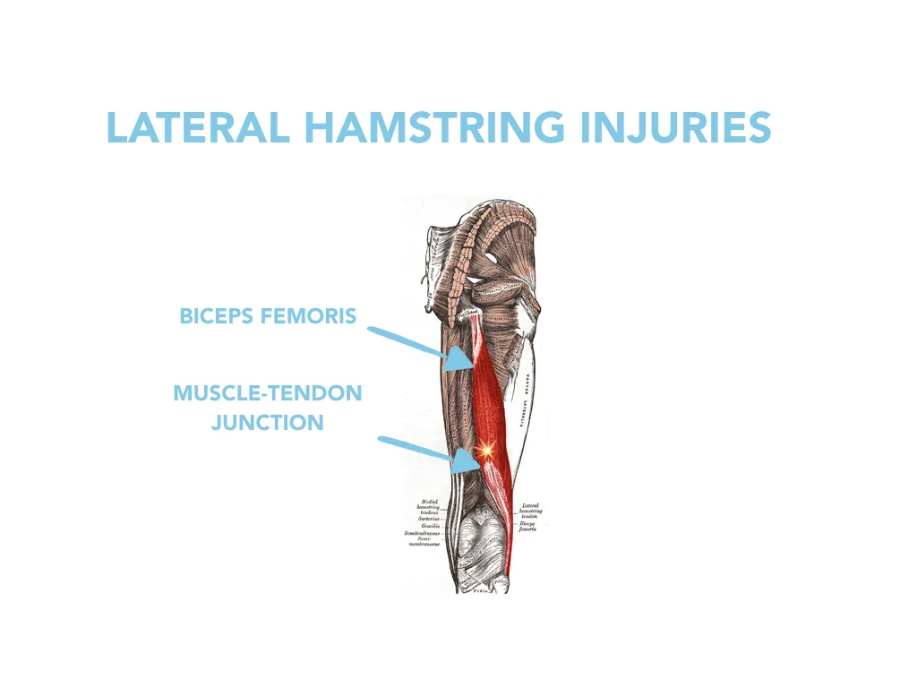 FLOW PHYSIO CO - FLOW KNOWS - Hamstring Injuries